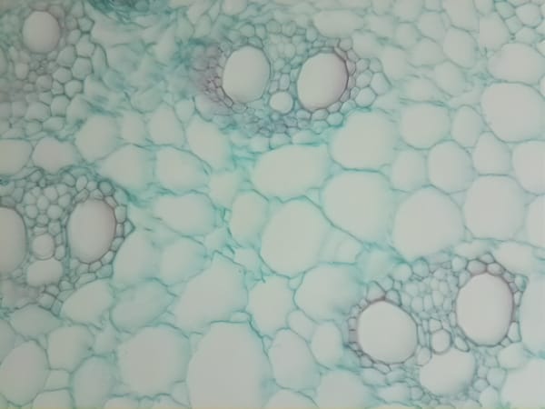 Spotlight: Building an OpenFlexure Microscope