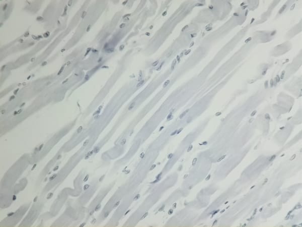 Spotlight: Building an OpenFlexure Microscope