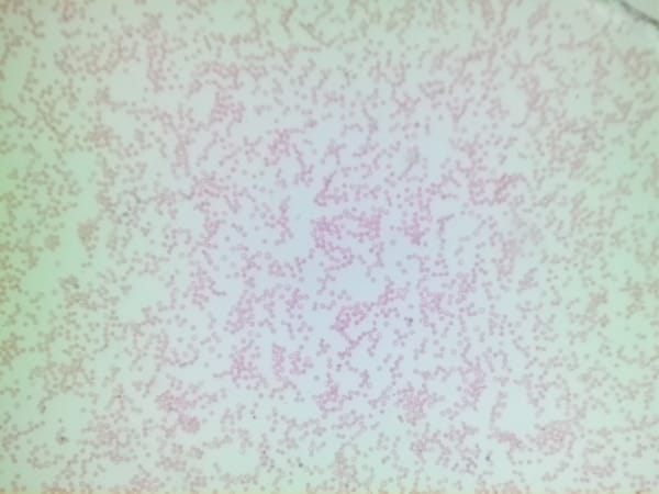 Spotlight: Building an OpenFlexure Microscope